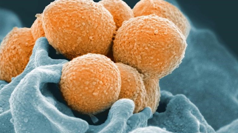 Invasive Group A streptococcal disease cases rising in region: ROW ...